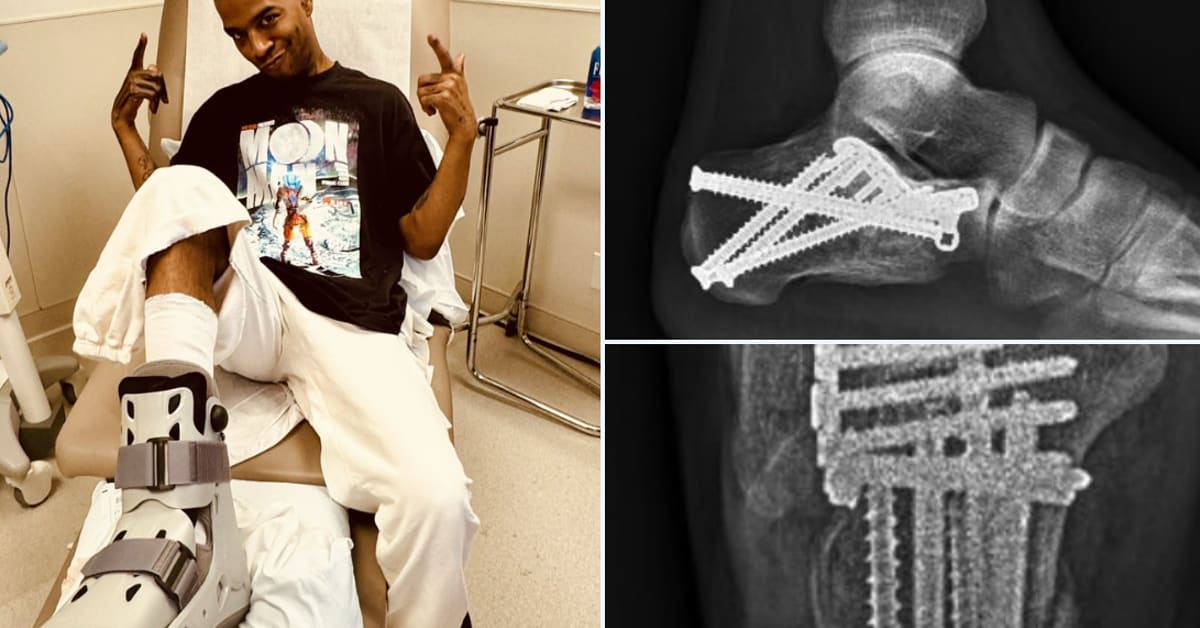 Kid Cudi Jokes He's a 'Cyborg Now' as He Shares X-Rays of...