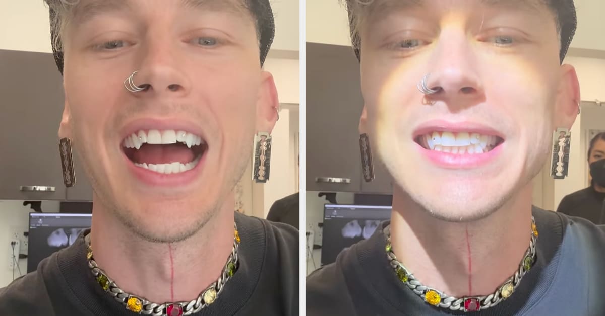 Machine Gun Kelly Introduces New Dentist-Made Fangs: 'With the Blessing ...