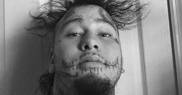 Footage Emerges of Stitches Getting Jumped By His Own Friends