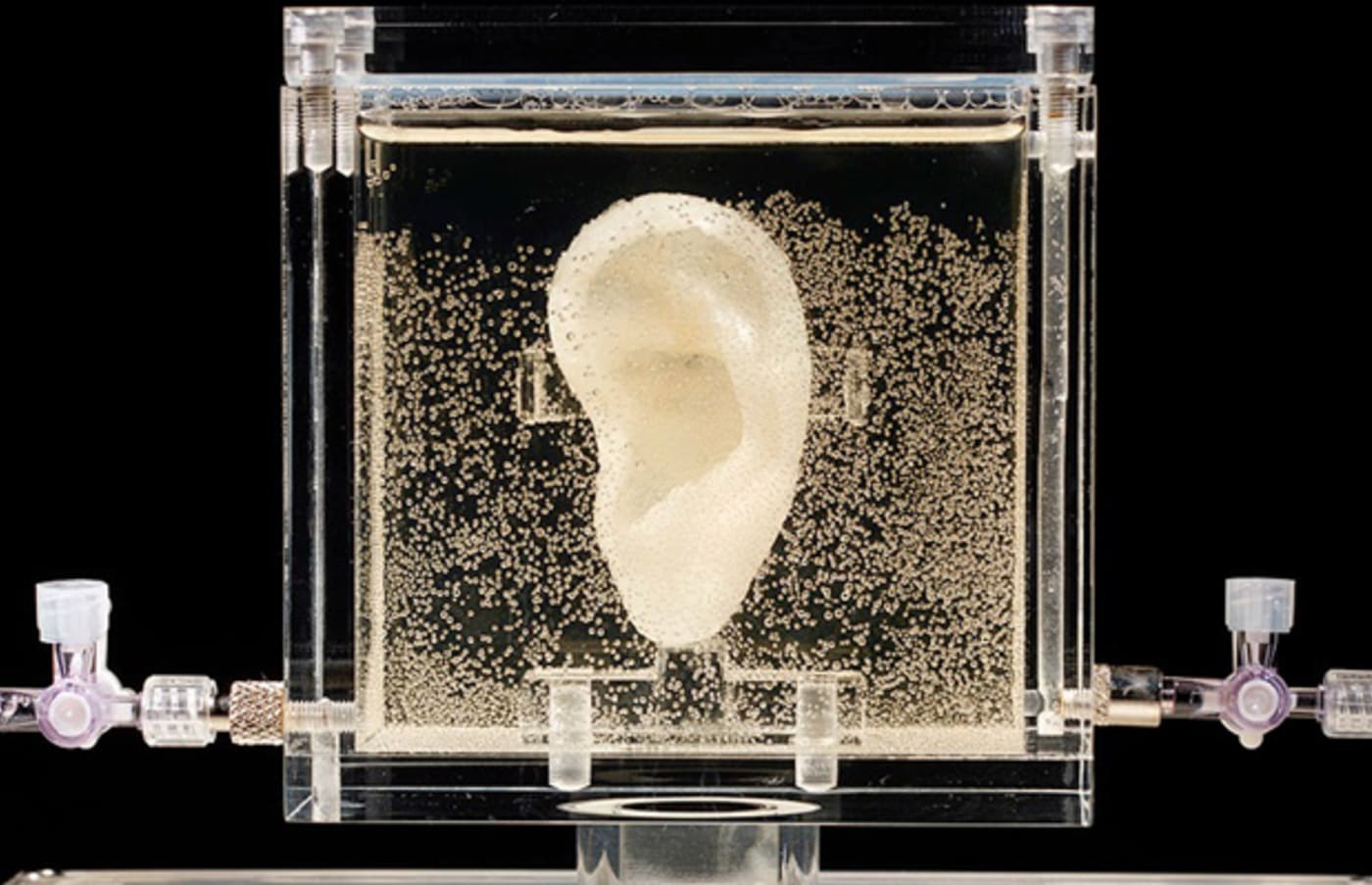 A Dutch Artist Re-Created Vincent Van Gogh’s Missing Ear From the ...