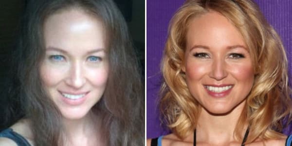 Jewel Got Her Teeth Fixed | Complex