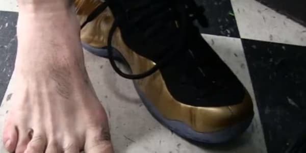 Boxer Danny Garcia Has Six Toes on His Right Foot | Complex