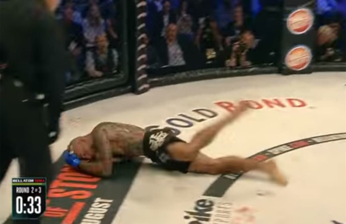 MMA Fighter Evangelista "Cyborg" Santos Suffered a Fractured Skull ...