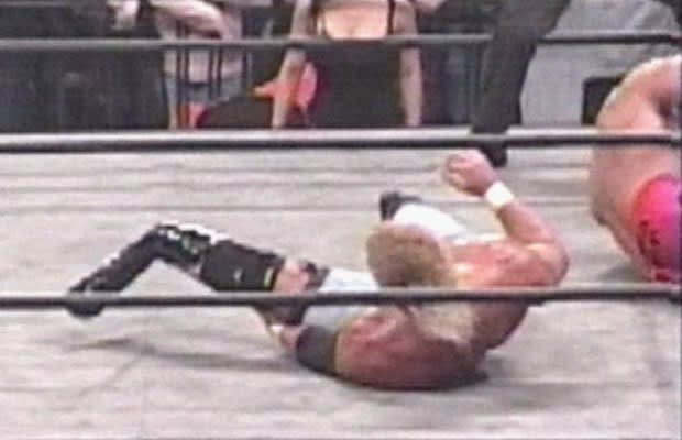 Sid Vicious - Gallery: The Most Gruesome Sports Injury Photos Part II ...