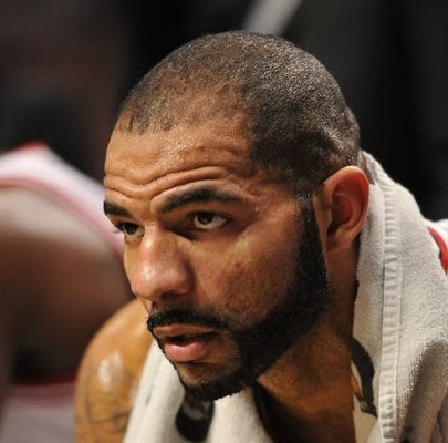 Carlos Boozer Hair Transplant