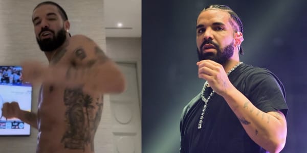 Drake Shirtless Photo Leads to Speculation He’s Had Work Done on His ...