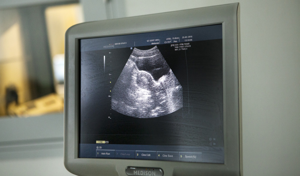 Fertility Doctor Who Impregnated Women With Own Sperm Agrees To 10m