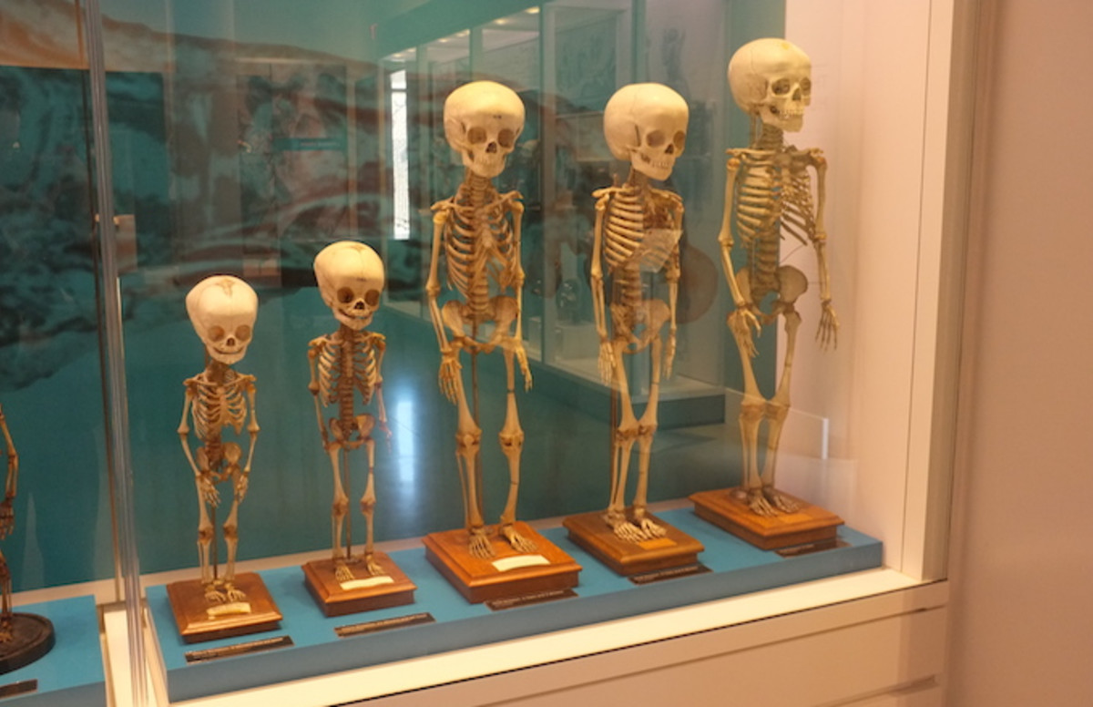 unearthed-skeleton-shows-how-people-in-fifth-century-tried-to-prevent
