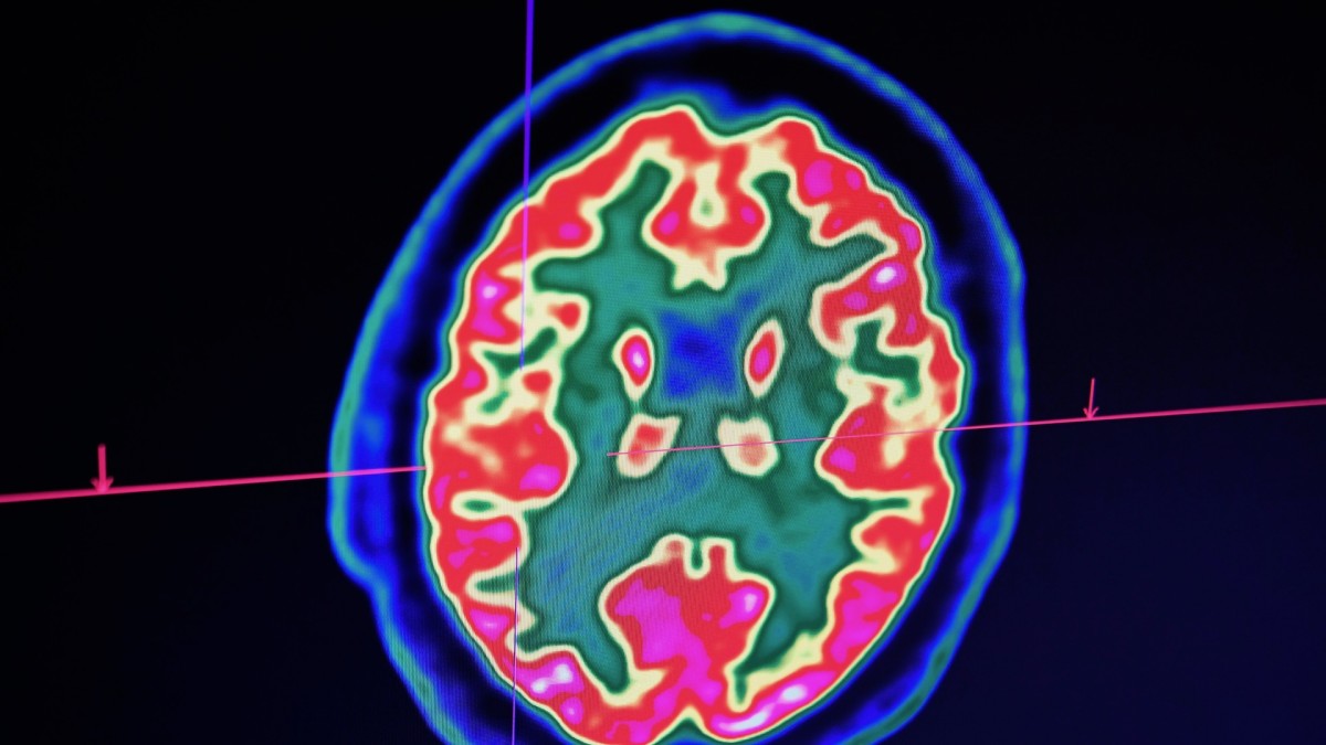 Researchers Discover Some Brain Cells Come Alive and Grow Hours After ...